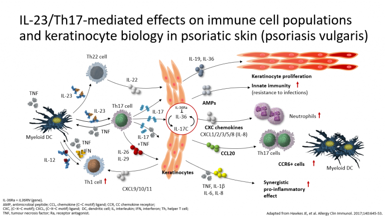 Figure 1. IL-23/Th17-mediated effects on immune cell populations and ...